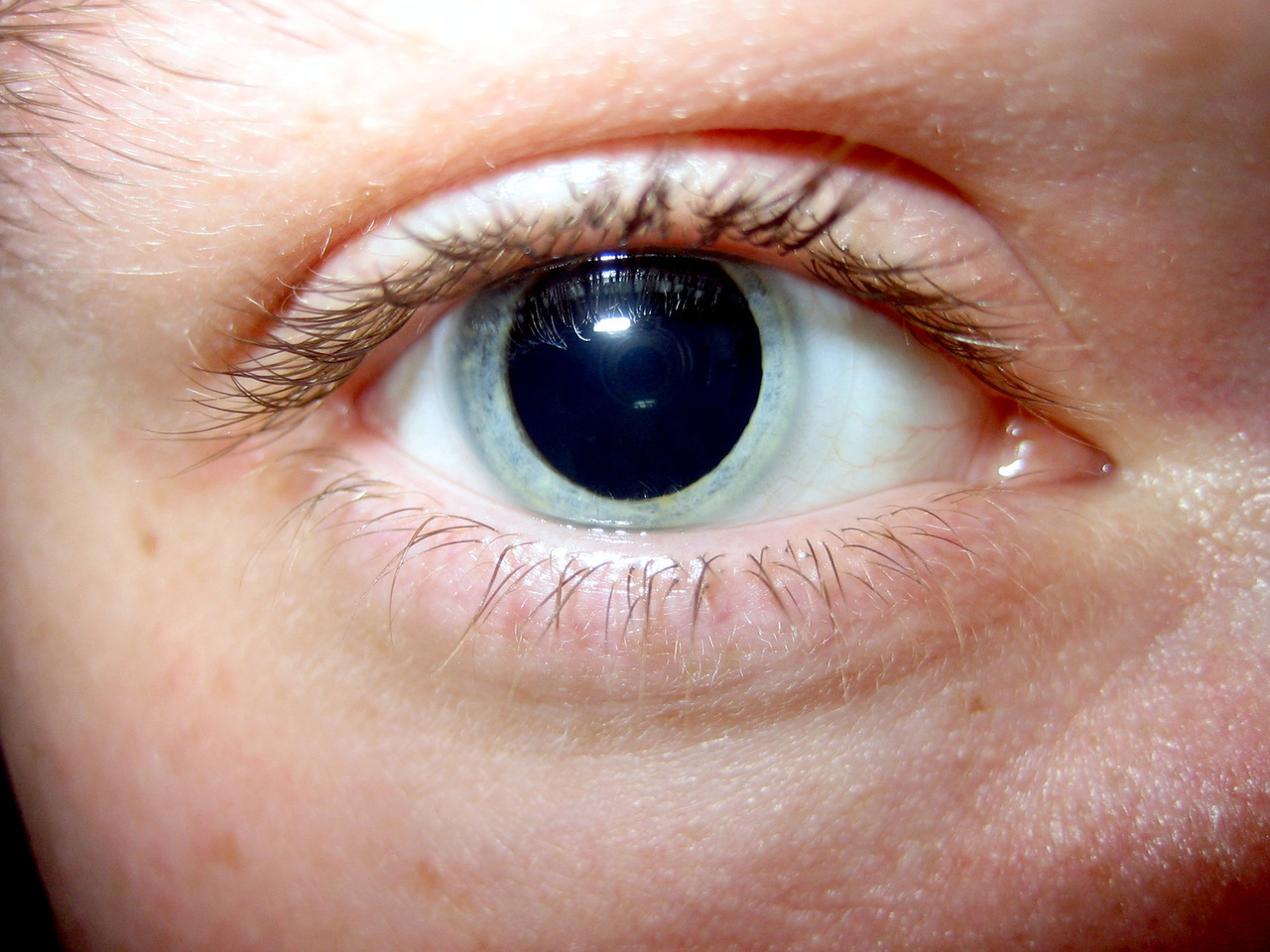 Pupil Dilation A Crucial Part Of Your Comprehensive Eye Exam Pupil Dilation A Crucial Part Of Your Comprehensive Eye Exam
